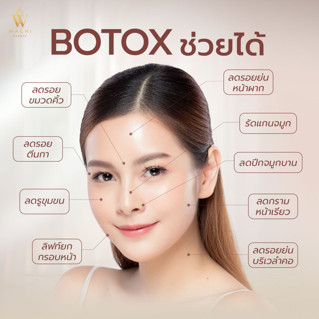 ฉีดโบท็อกซ์ ที่ Wachi Clinic โคราช — หน้าใส เรียว กระชับ