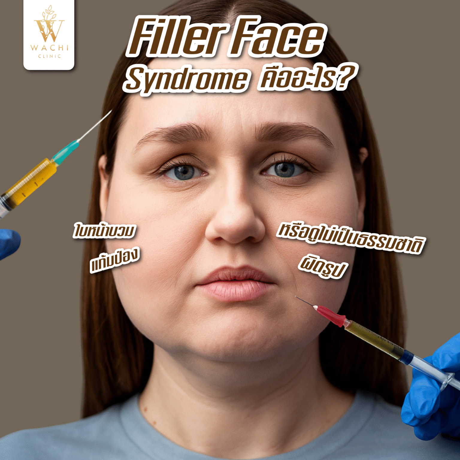 Filler Face Syndrome คืออะไร?