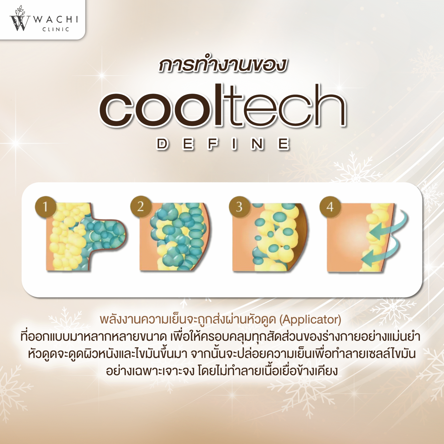 Cooltech Define สลายไขมันด้วยความเย็น โคราช ไม่ต้องผ่าตัด